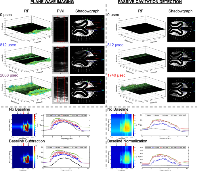 Acoustic Detection of Intracranial Cavitation Induced by Blunt Impacts ...