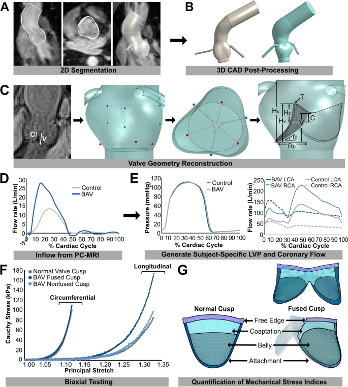 Patient-Informed Fluid-Structure Interaction Simulations of Bicuspid ...