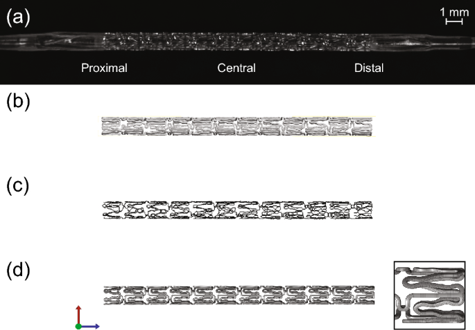 Toward Lesion-specific Stenting Strategies: A Computational Framework ...