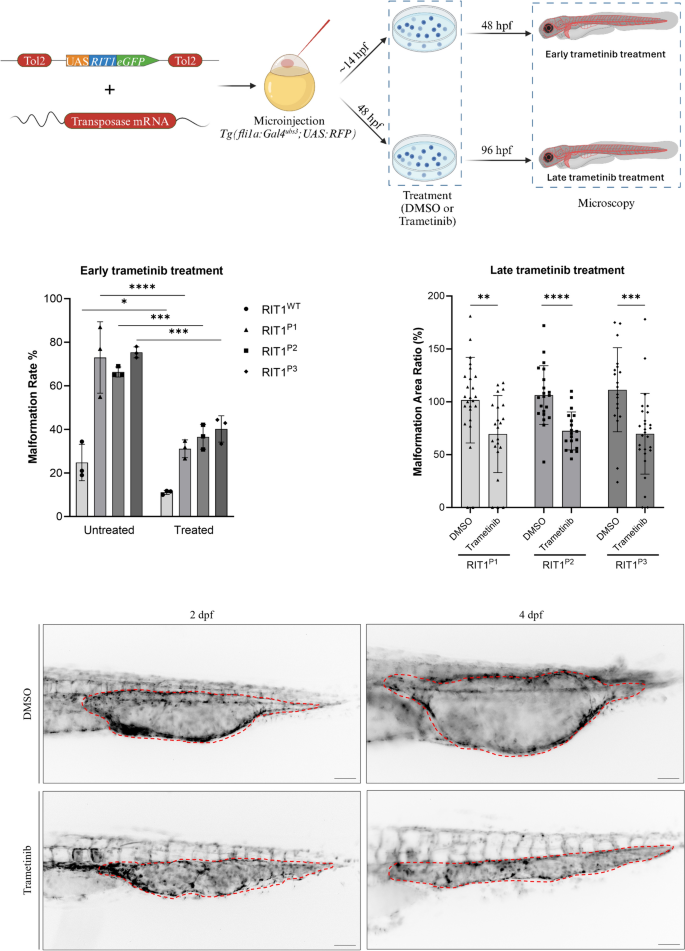 Somatic RIT1 delins in arteriovenous malformations hyperactivate RAS ...