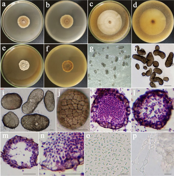 Additional new species of Preussia from forest trees in Iran | Antonie ...