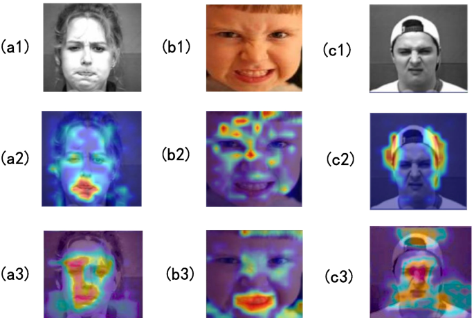 Emotion recognition by global and local feature fusion for people with ...