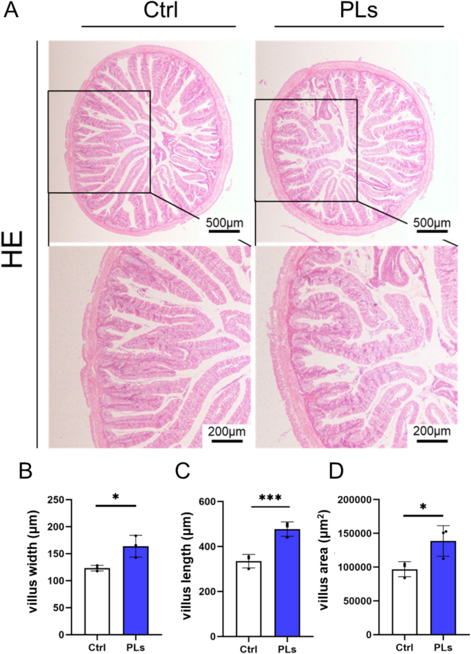 Dietary phospholipid promotes growth, intestinal health, and muscle and ...