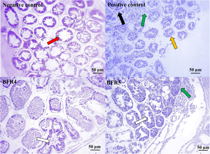 Effect of Halamphora coffeaeformis supplementation in rice bran biofloc ...