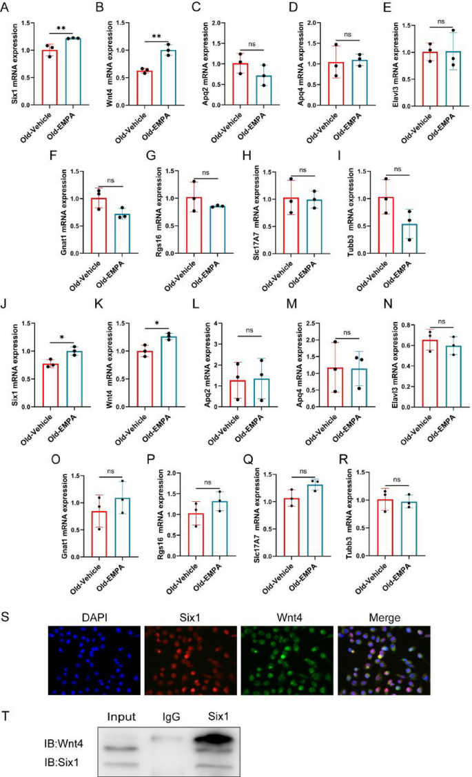 Empagliflozin slows down natural kidney senescence via Six1/Wnt4/NF-κB ...