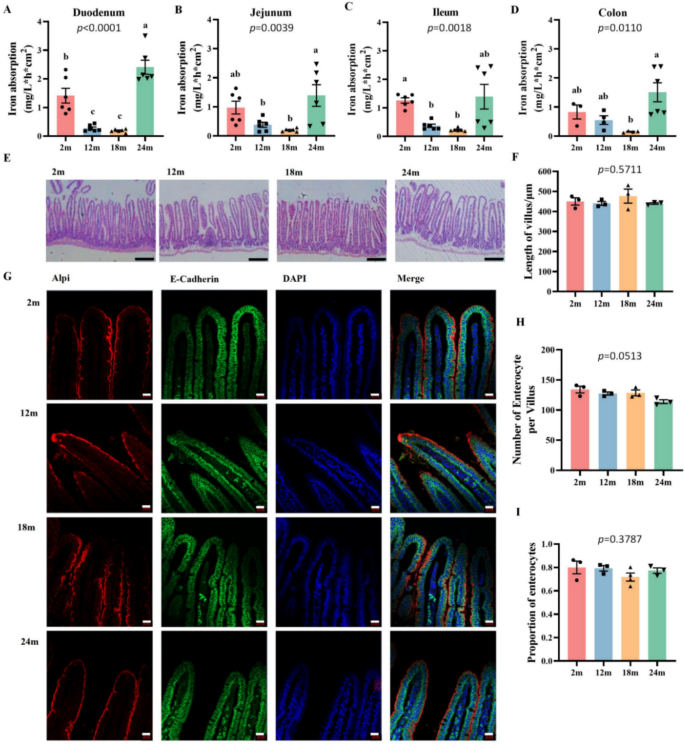 High intestinal iron absorption induced by decreased hepcidin leads to ...