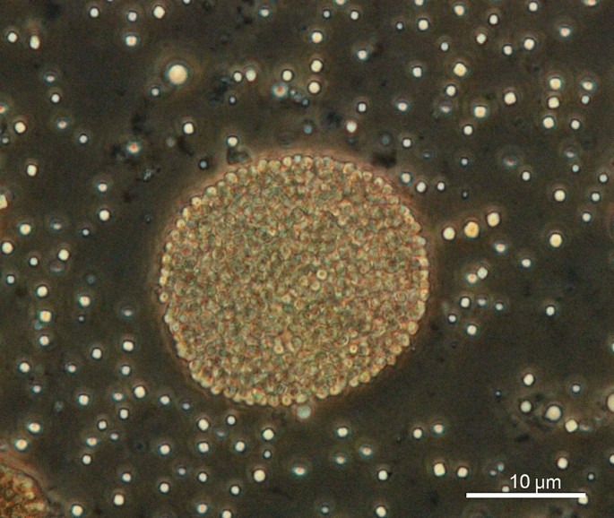 Characterization of a cypovirus isolate in Noctuoidea pests: host range ...