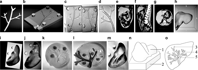 Development of a liver phantom for training in the diagnosis of ...