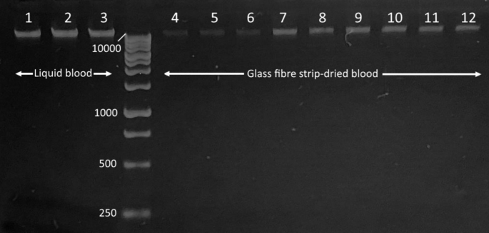 Optimization of Total DNA Extraction from Dried Blood Samples ...