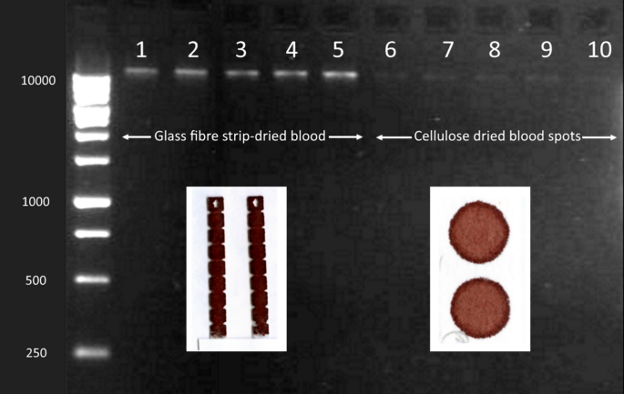 Optimization of Total DNA Extraction from Dried Blood Samples ...