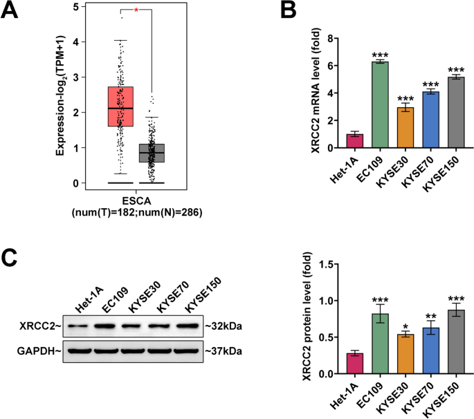 XRCC2 knockdown effectively sensitizes esophageal cancer to albumin ...