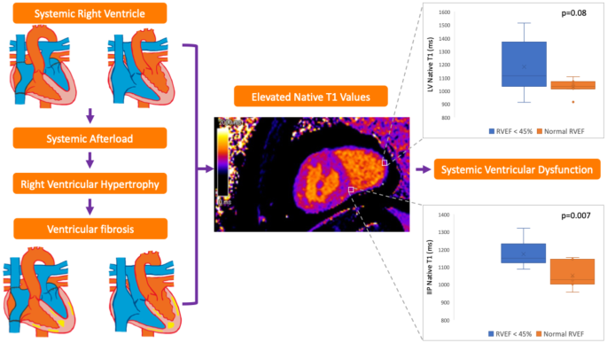 T1 mapping: a non-invasive tool to assess the systemic right ventricle ...