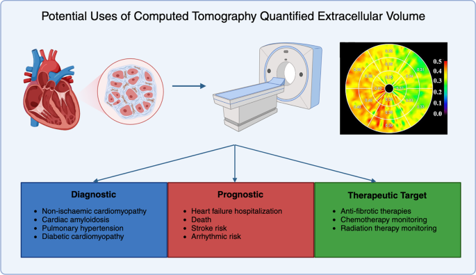 Myocardial extracellular volume measurement using cardiac computed ...