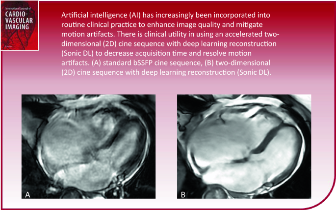 Comprehensive review of artifacts in cardiac MRI and their mitigation | The International ...