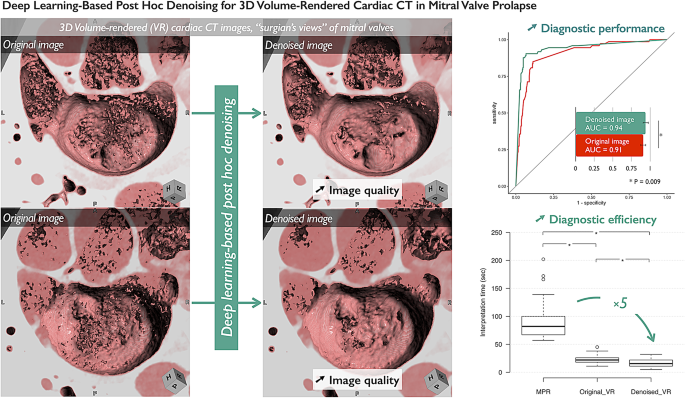 Deep learning-based post hoc denoising for 3D volume-rendered cardiac CT in mitral valve ...