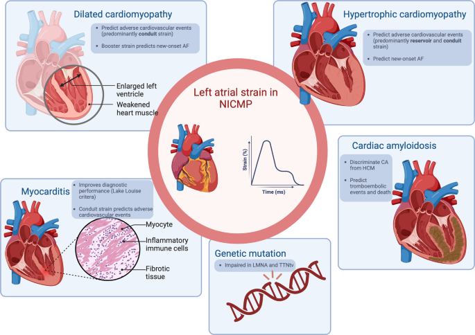 Clinical and prognostic impact of left atrial strain in non-ischemic ...