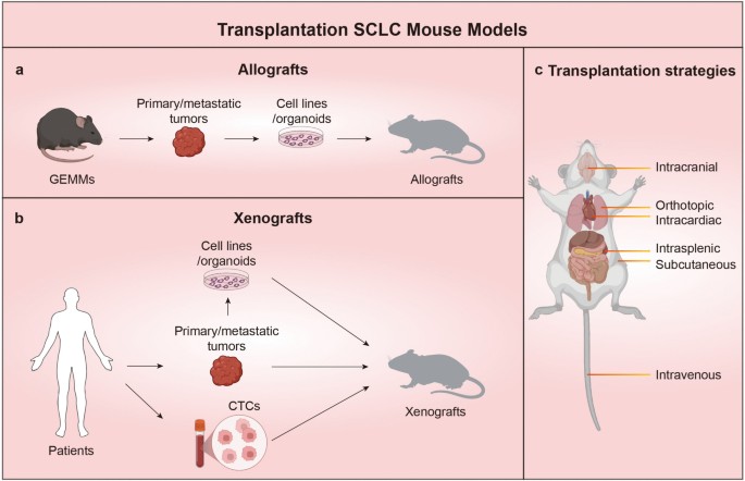 Advancing small cell lung cancer metastasis research: innovations in ...
