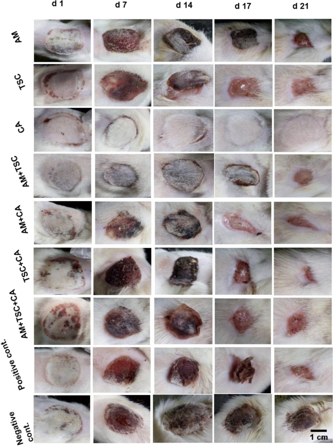 A comparative study of human amniotic membrane, tilapia skin collagen ...