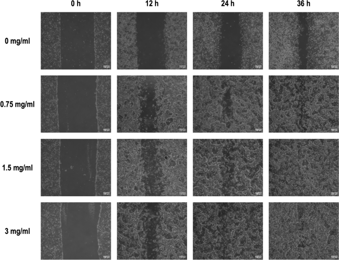 Amniotic membrane extract provides significant improvement in in vitro ...