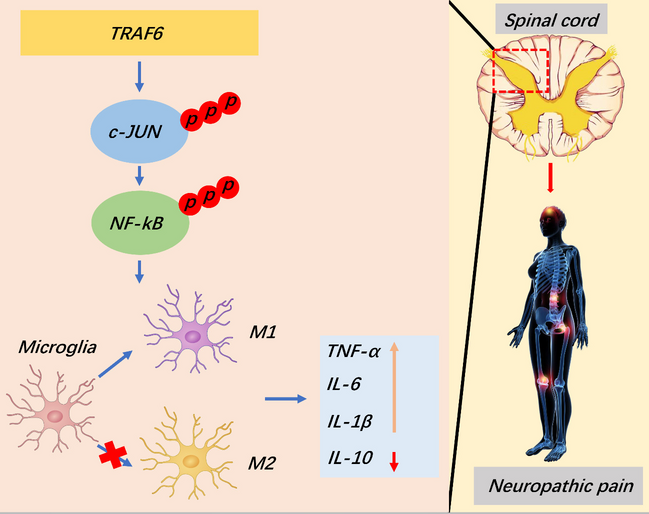 TRAF6 promotes spinal microglial M1 polarization to aggravate ...
