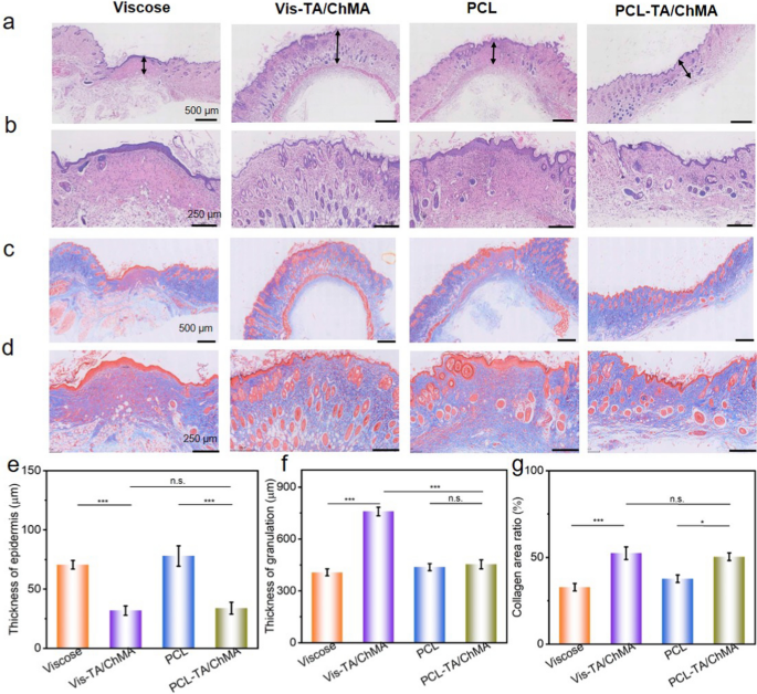 Antibacterial methacrylamide chitosan-modified viscose/poly(ε ...