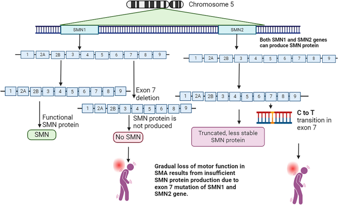 Spinal Muscular Atrophy: Current Medications and Re-purposed Drugs ...