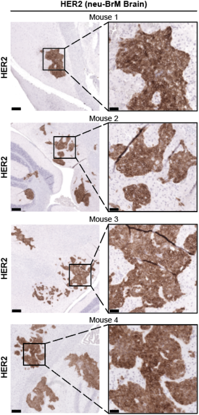 A new, immunocompetent brain-metastatic mouse model of HER2-positive ...