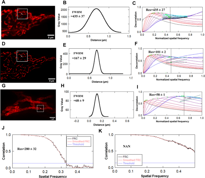 Resolution assessment of super-resolution microscopy imaging ...