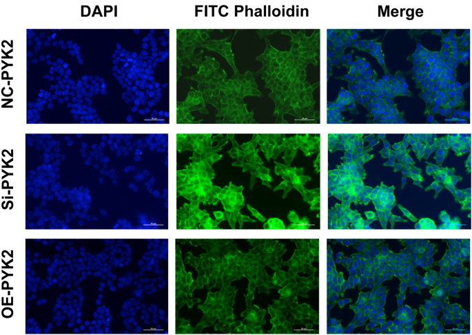 Reduced Proline-Rich Tyrosine Kinase 2 Promotes Tumor Metastasis by ...