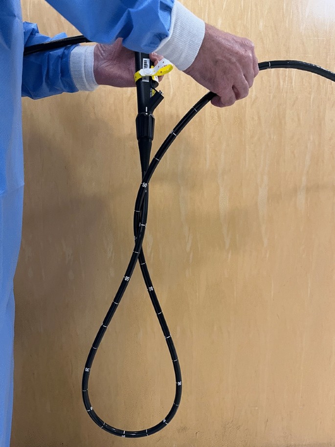Enemy of Colonoscope Insertion: Looping | Digestive Diseases and Sciences