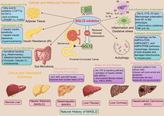The Emerging Therapeutic Promise of SGLT2 Inhibitors in Metabolic ...