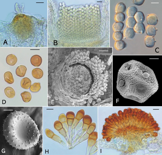 The heteroecious life cycle of a rust fungus, Puccinia rupestris on ...