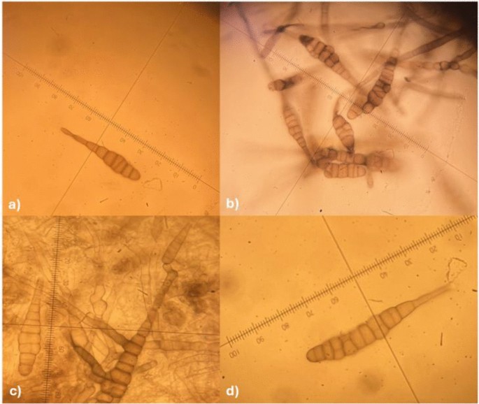 Occurrence of Alternaria brassicae in canola (Brassica napus L.) and ...