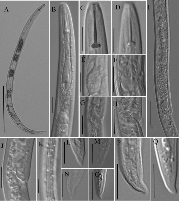 Morphological and molecular characterization of Paratylenchus sacchari ...