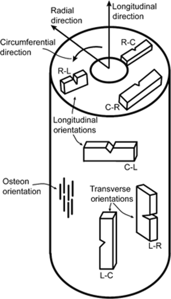Heterogeneous fracture toughness of human cortical bone tissue ...