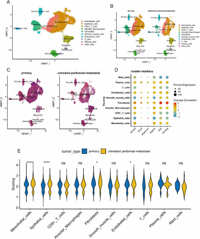 Spatial single-cell maps reveal ST6GAL1 promoting ovarian cancer ...