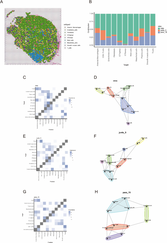 Spatial single-cell maps reveal ST6GAL1 promoting ovarian cancer ...
