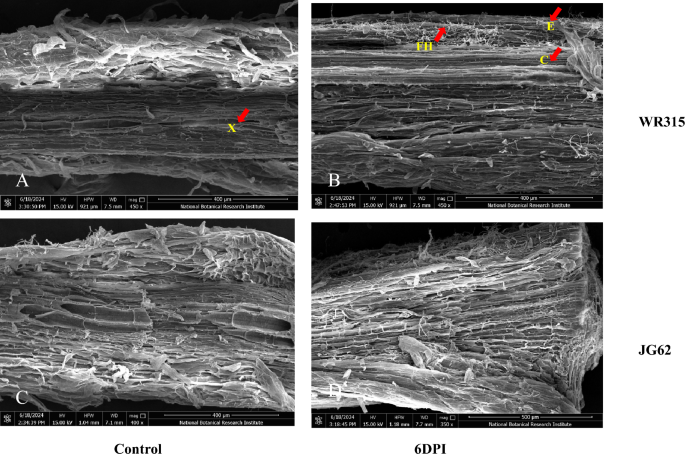 Callose metabolism genes in chickpea reveal vascular defense against ...