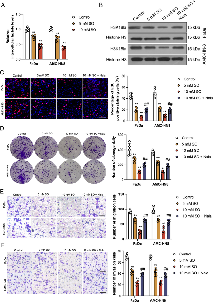 Histone H3K18 lactylation-dependent epigenetic activation of RUNX2 ...