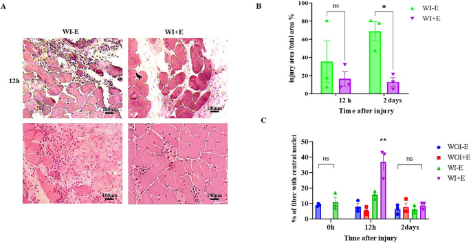 Epicatechin accelerates muscle repair and promotes hypertrophy in type ...