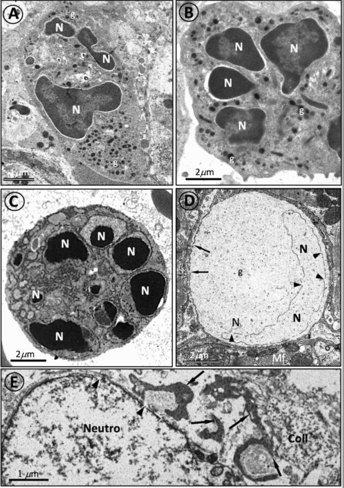 The role of NETosis in heart failure | Heart Failure Reviews