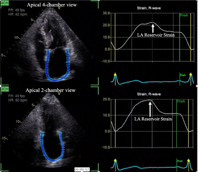 Evolving role of echocardiography across the heart failure spectrum ...