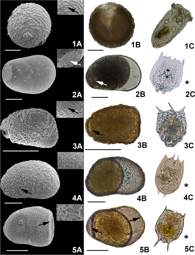 Diversity of diapausing egg ornamentation in rotifer species ...