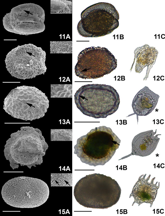Diversity of diapausing egg ornamentation in rotifer species ...