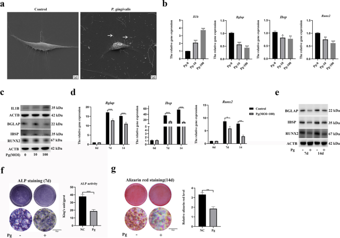 Platr3/NUDT21/NF-κB Axis Mediates P. gingivalis-Suppressed Cementoblast ...