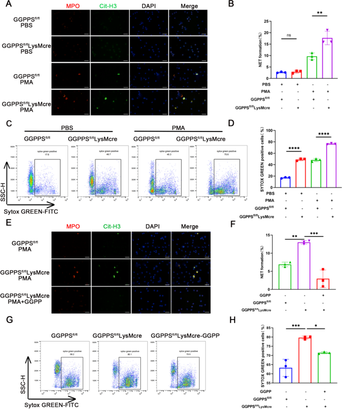 GGPPS Negatively Regulates the Formation of Neutrophil Extracellular ...
