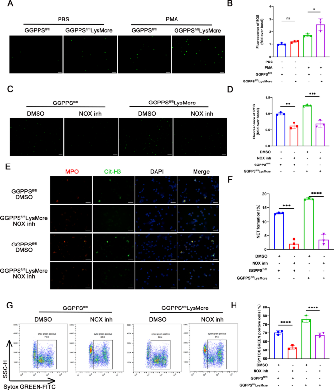GGPPS Negatively Regulates the Formation of Neutrophil Extracellular ...