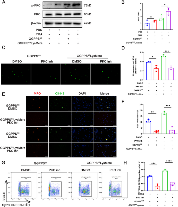 GGPPS Negatively Regulates the Formation of Neutrophil Extracellular ...