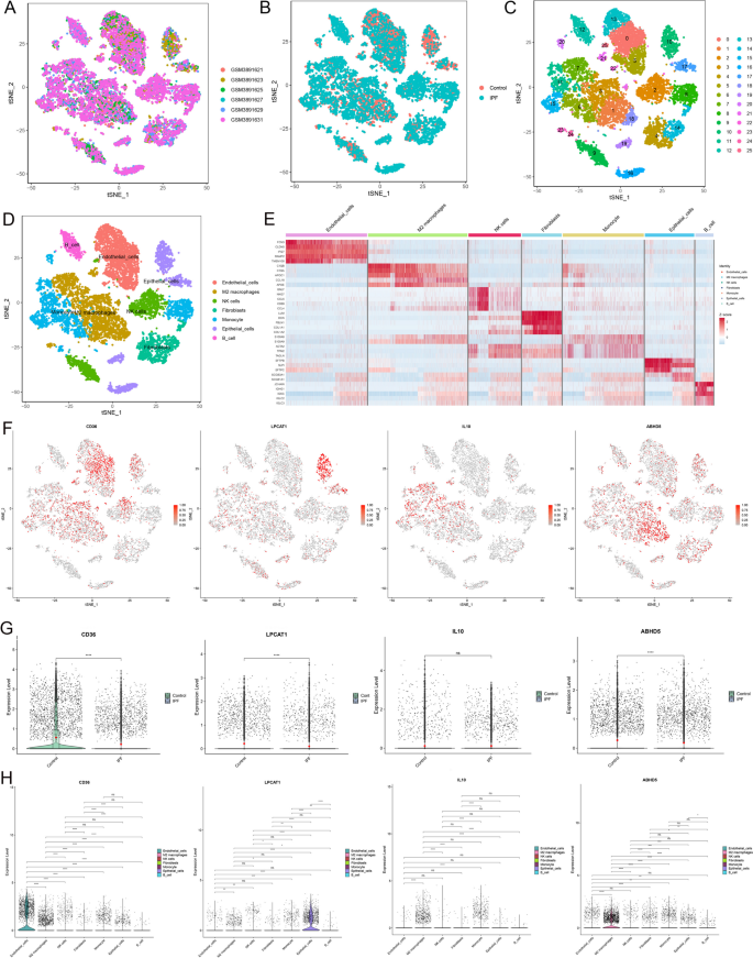 Exploring ABHD5 as a Lipid-Related Biomarker in Idiopathic Pulmonary ...