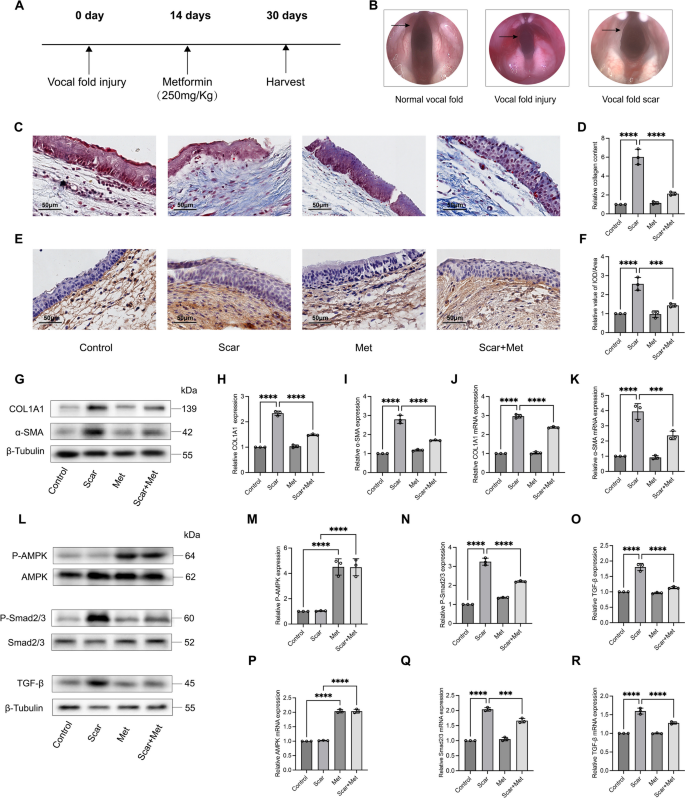 Metformin Attenuates Vocal Fold Fibrosis via AMPK Signaling | Inflammation